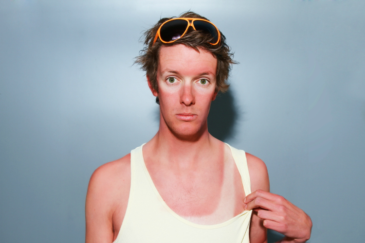 SPF: Sunburns Are Pretty Funny (Hilarious Photos to Prove It) - Mandatory
