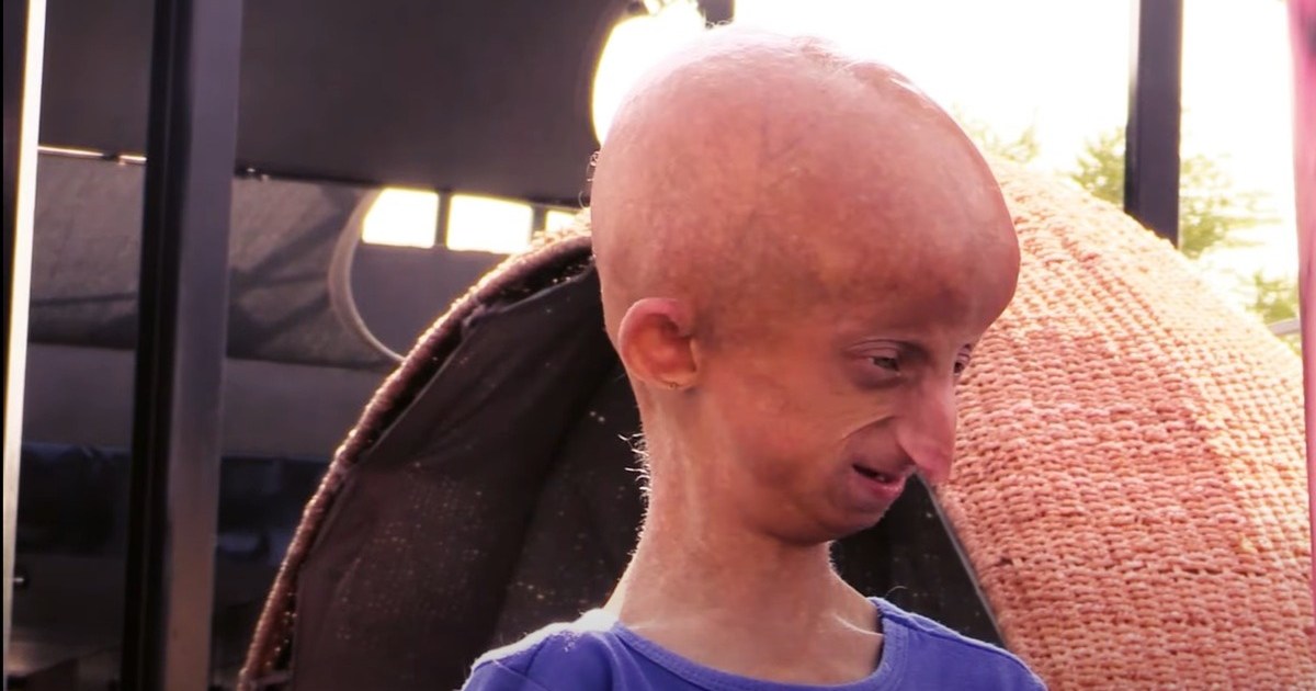 TikTok Star Beandri Booysen Passes Away at 19 - Mandatory