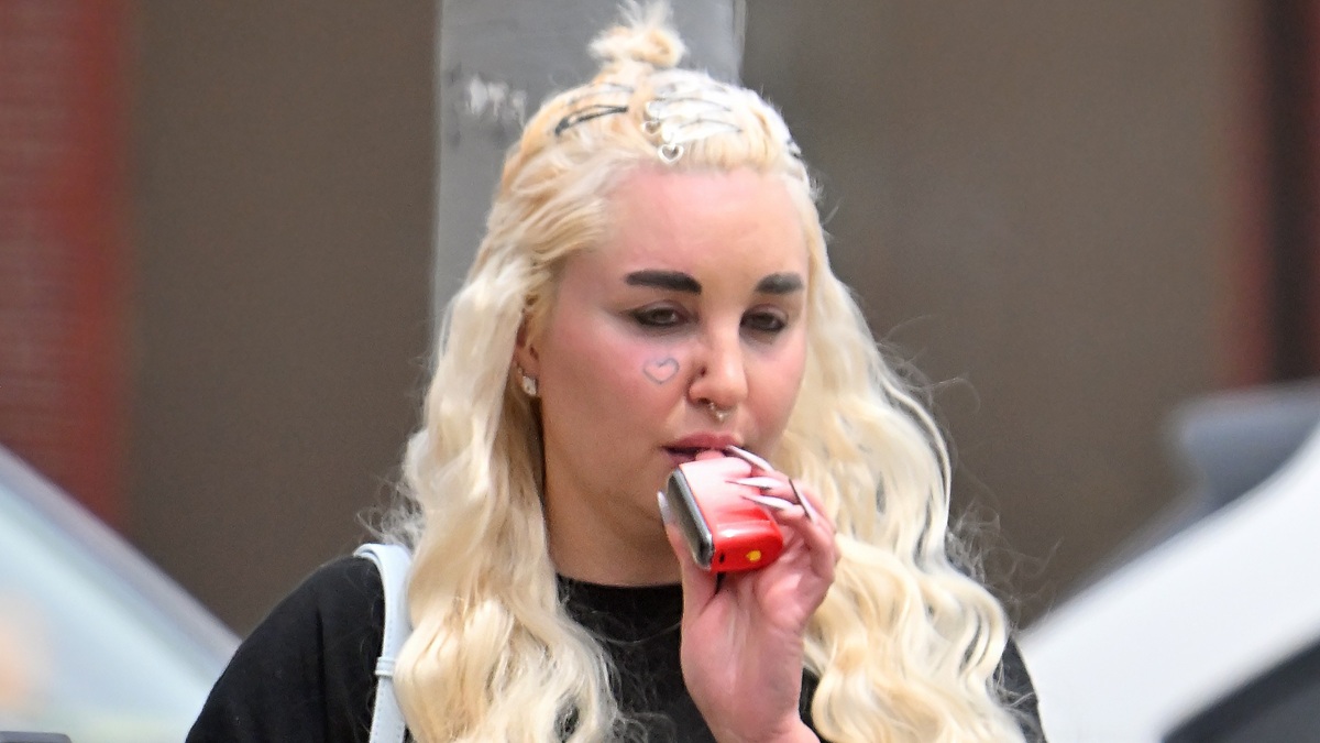 Amanda Bynes Before & After: What Happened to Her Face? - Mandatory