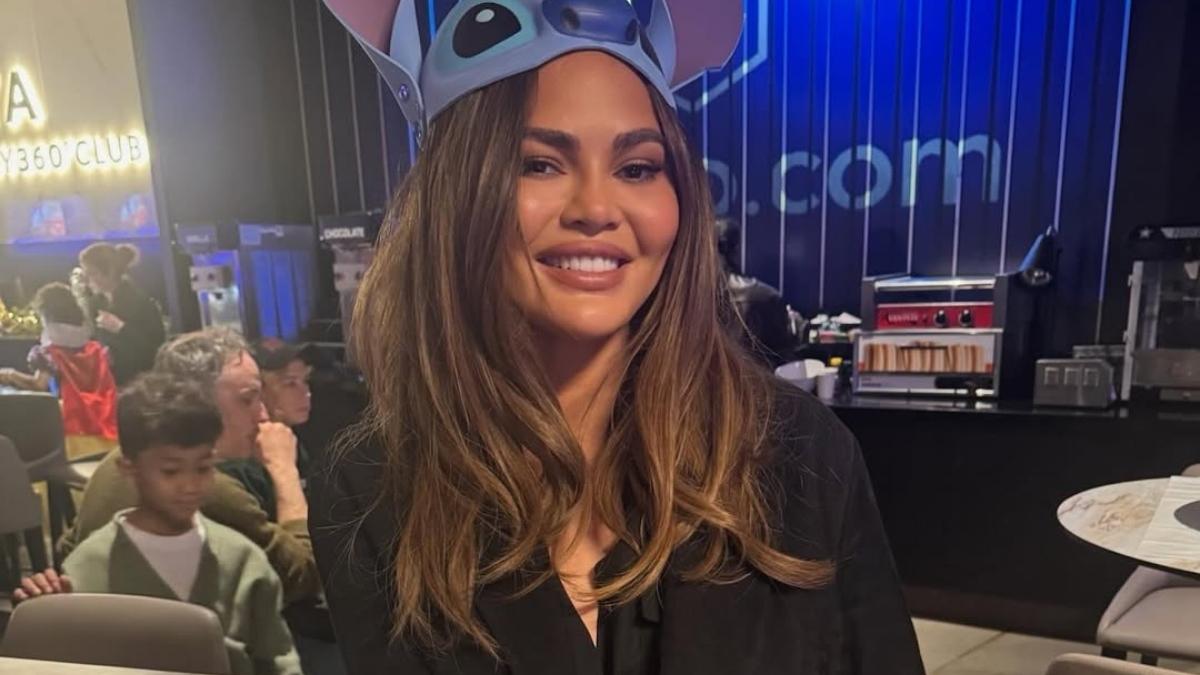 Chrissy Teigen Gets Tooth Fixed After Candy Cane Incident - Mandatory